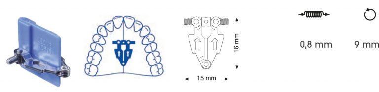 Symmetrische Fächerdehnschraube - Orthobasics
